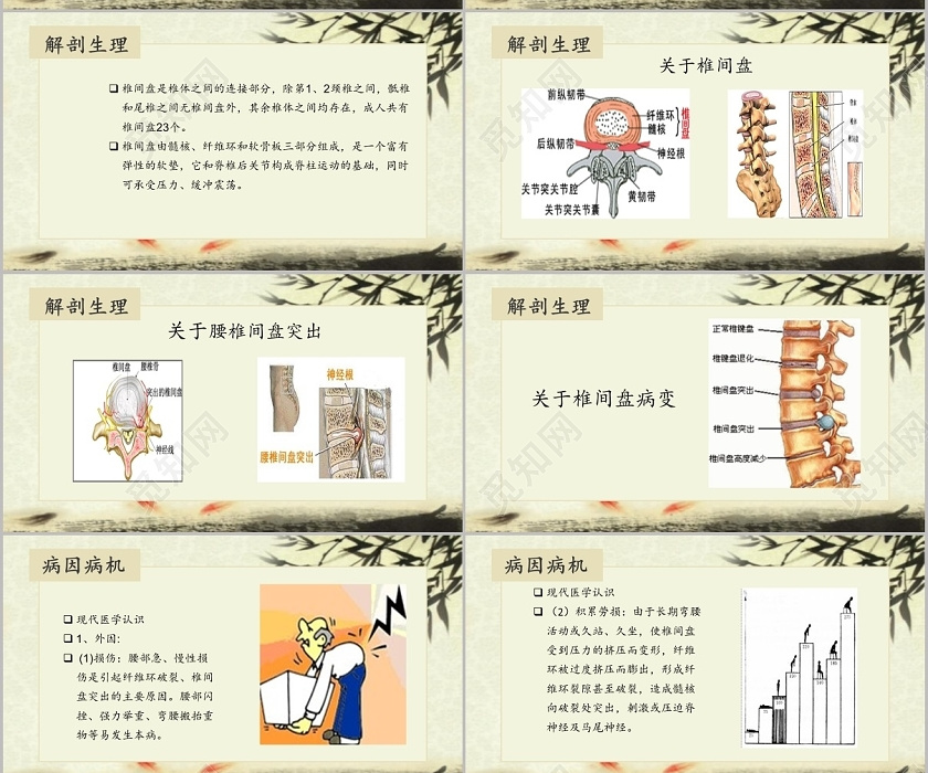 古风腰椎间盘突出症腰椎骨科护理查房PPT模板下载 觅知网